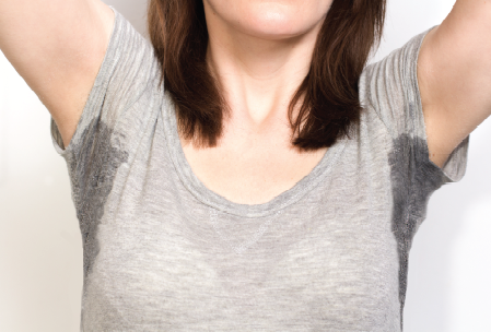 Sweaty Underarms International Hyperhidrosis Society Official Site